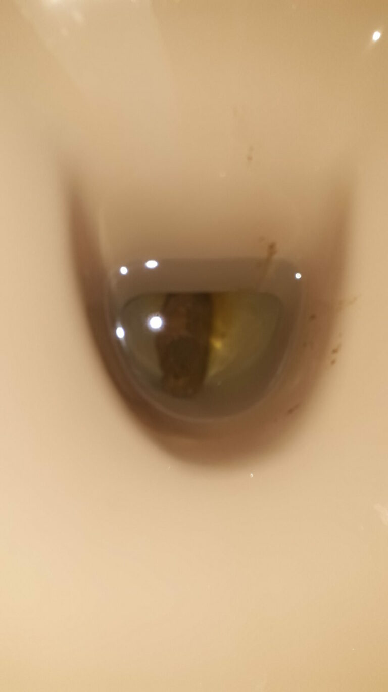 Normal poop - Note Mon Caca.fr