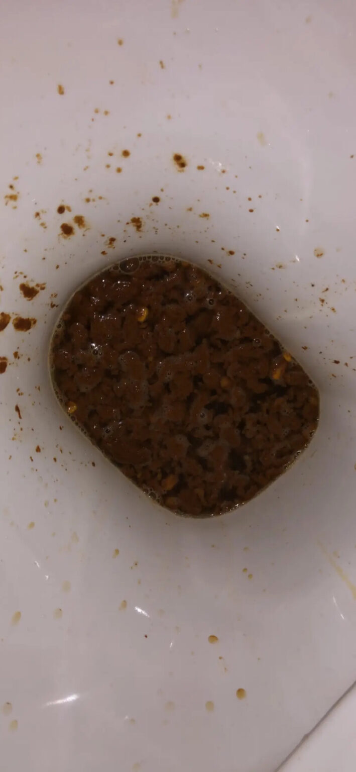 Diarhée au lycee - Note Mon Caca.fr