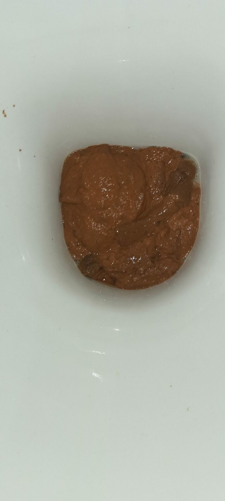 ATOMIC DIARREA - Rate my poo.eu