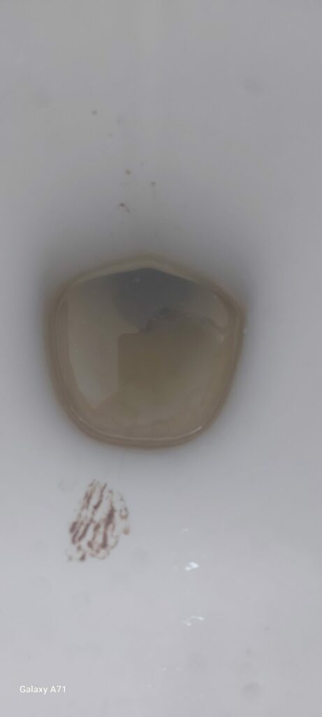 Hidden poop - Rate my poo.eu