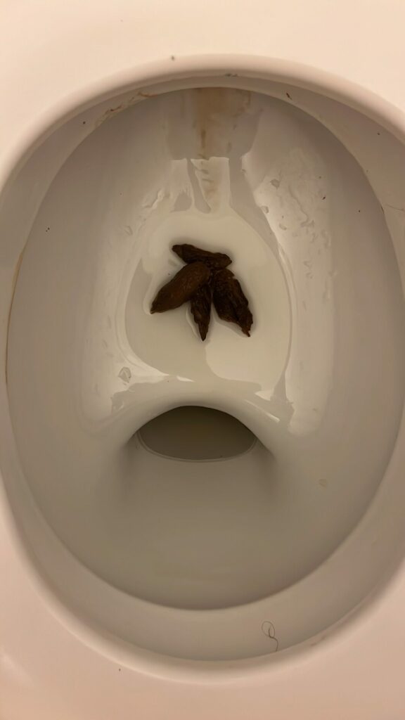 Adidas OG poop - Rate my poo.eu